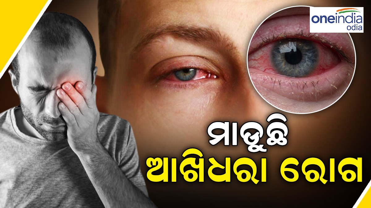 ମାଡ଼ି ଆସୁଛି ଆଖିଧରା ରୋଗ: ଜୁଲାଇ ମାସରେ ରୁହନ୍ତୁ ସାବଧାନ | Eye Disease in ...