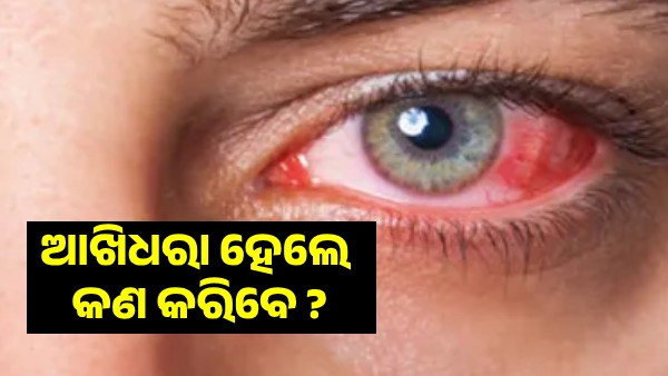ରାଜ୍ୟରେ ବ୍ୟାପୁଛି ଆଖିଧରା ରୋଗ, ଜାଣନ୍ତୁ କଣ କରିବେ ଏବଂ କଣ କରିବେ ନାହିଁ ...